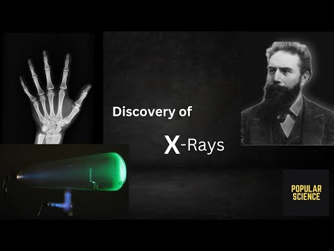 History of X-ray | From discovery to modern day technology