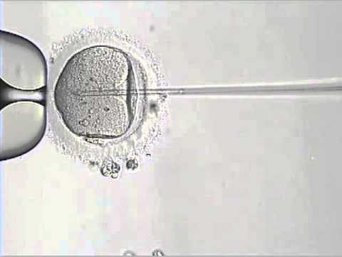 Intracytoplasmic Sperm Injection Procedure (ICSI)