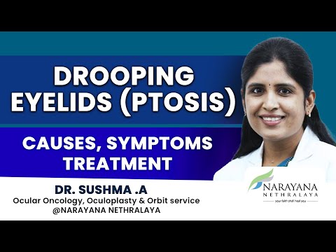 Drooping Eyelids (Ptosis): Know its Causes, Symptoms and Treatment (Kannada)