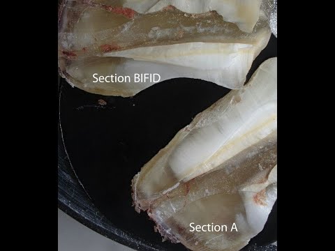 644 Section A & Bifid