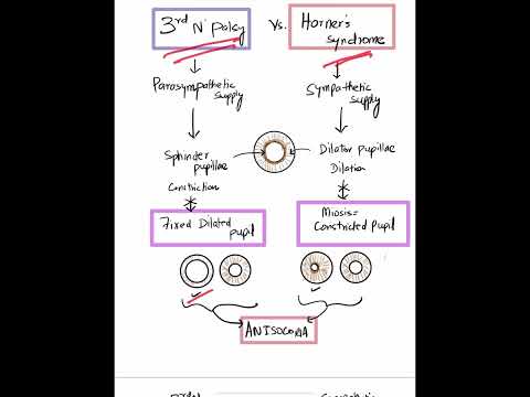 3rd Nerve Palsy vs. Horner’s Syndrome #Shorts