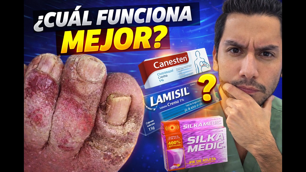 ¿Qué Crema Elimina los Hongos MÁS RÁPIDO? | Tratamiento para PIE DE ATLETA