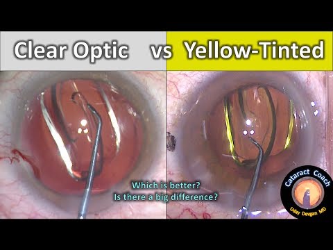 Foldable Intraocular Lenses at Best Price in India