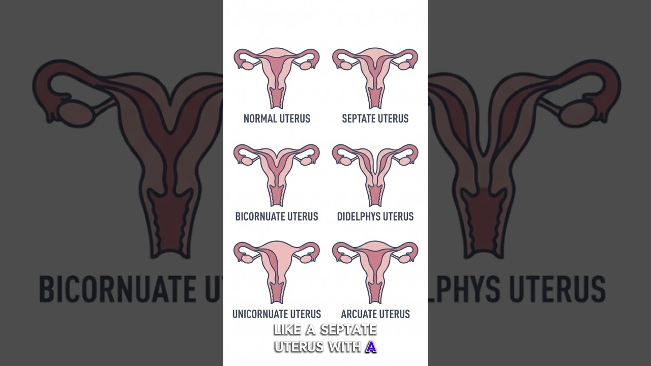 6 Types of Uterus You Didn’t Know Existed#shorts#viral#WomensHealth#StrangeBodyFacts#HumanAnatomy