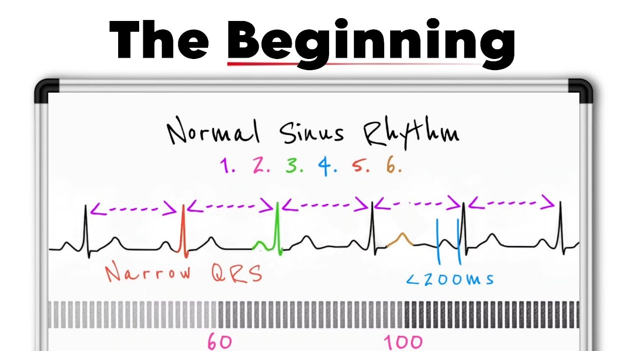 Normal Sinus Rhythm Explained | ECG Interpretation for Beginners