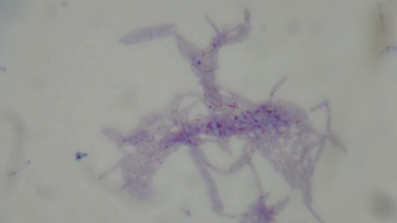 Bacillus anthracis ANTHRAX ENDOSPORES