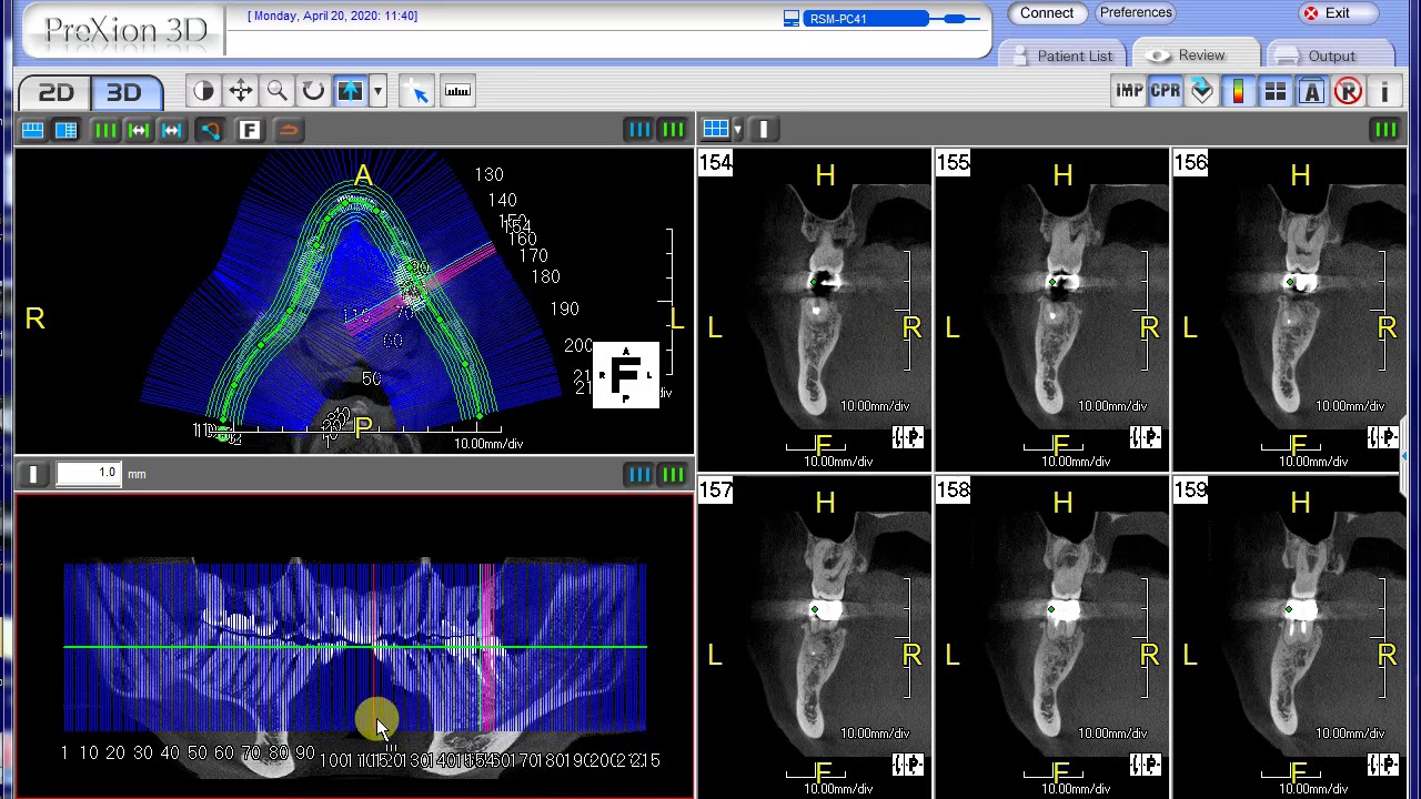 PreXion Training Tips: Cross Sections and Panoramic Generated from CPR