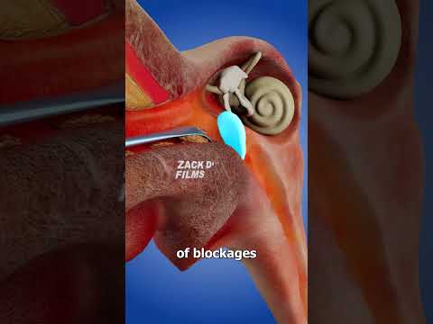 How Ear Spoons Work π€