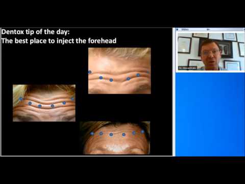 Botox Training – Injecting Forehead Properly – (858) 905-5780 – botoxedu