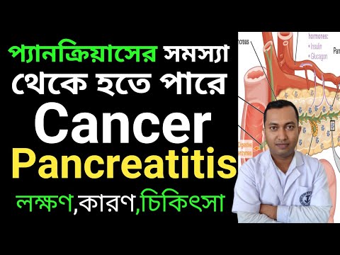 Pancreatitis in Bengali | Pancreatitis Treatment | Pancreatitis Symptoms|