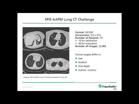2018 - Automated lung tumor diagnosis in medical image data - methods, challenges and perspectives
