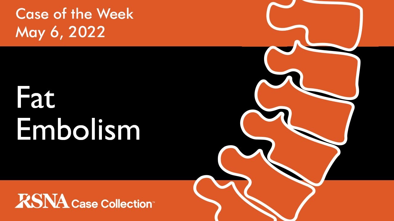 Case of the Week: Fat Embolism
