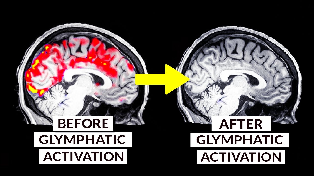 Understanding the Glimpmphatic System: How to Detox Your Brain ...