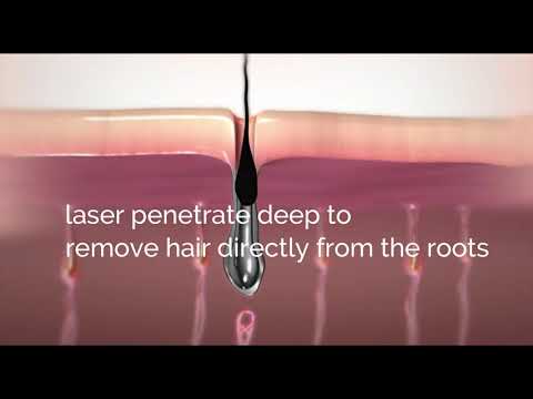 Laser Hair Removal - DPL / SHR Permanent Hair Removal - Bio Aesthetic Medispa