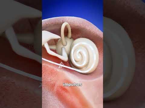 How Some Deaf People Can Hear ????