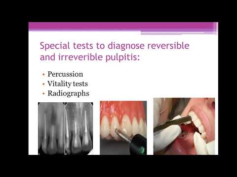 The difference between reversible pulpitis and irreversible pulpitis(MFDS/MJDF/ORE).