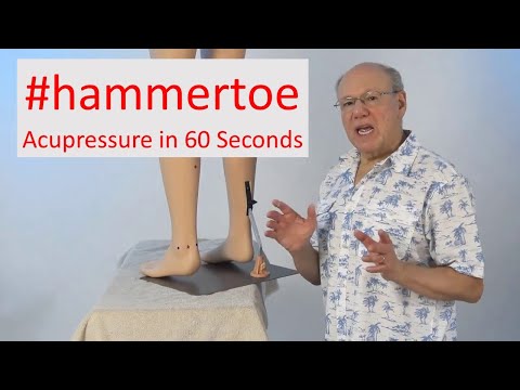 Toe-Tastic Solutions: Acupressure Technique for Hammertoe Relief