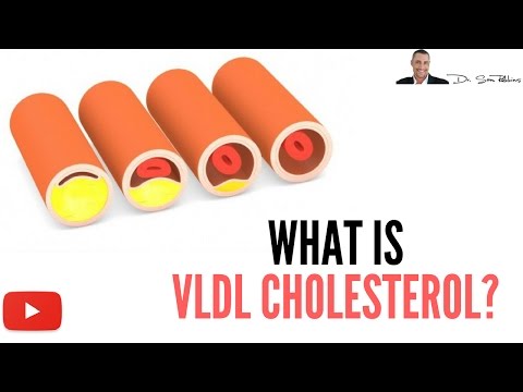 ► What Is VLDL Cholesterol ? - by Dr Sam Robbins