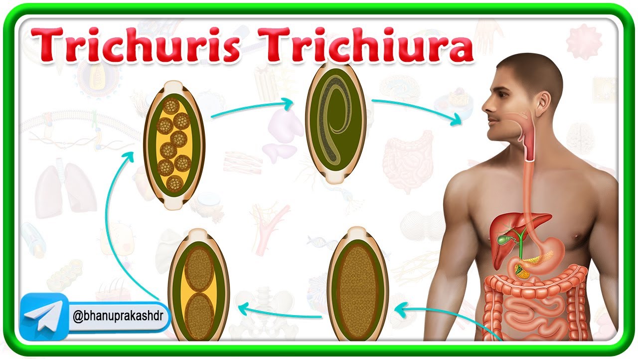 Trichuris Trichiura Microbiology  Animation : Lifecycle and Trichuriasis