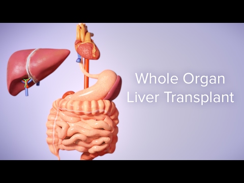 Liver Transplant | Cincinnati Children's