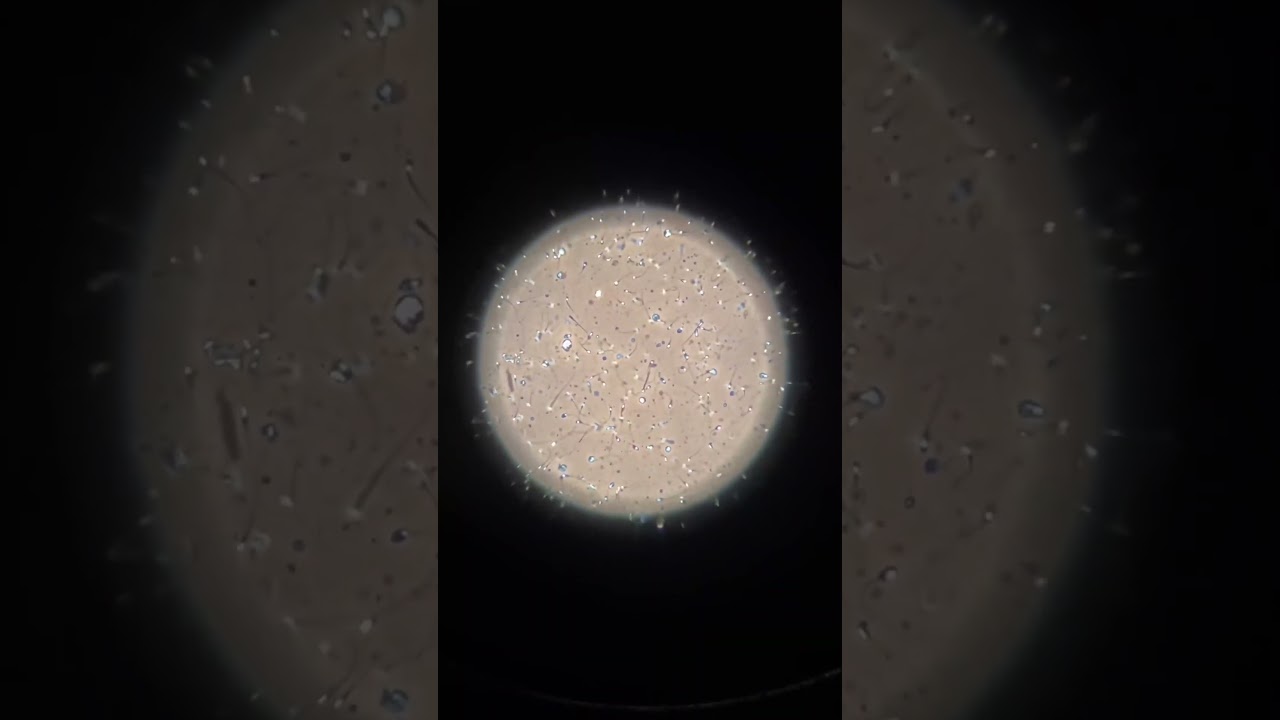 Sperm under a microscope