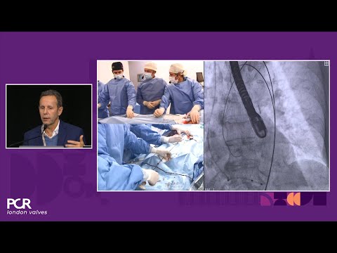 Zero-contrast TAVI while using a novel full-body embolic protection filter - PCR London Valves 2024