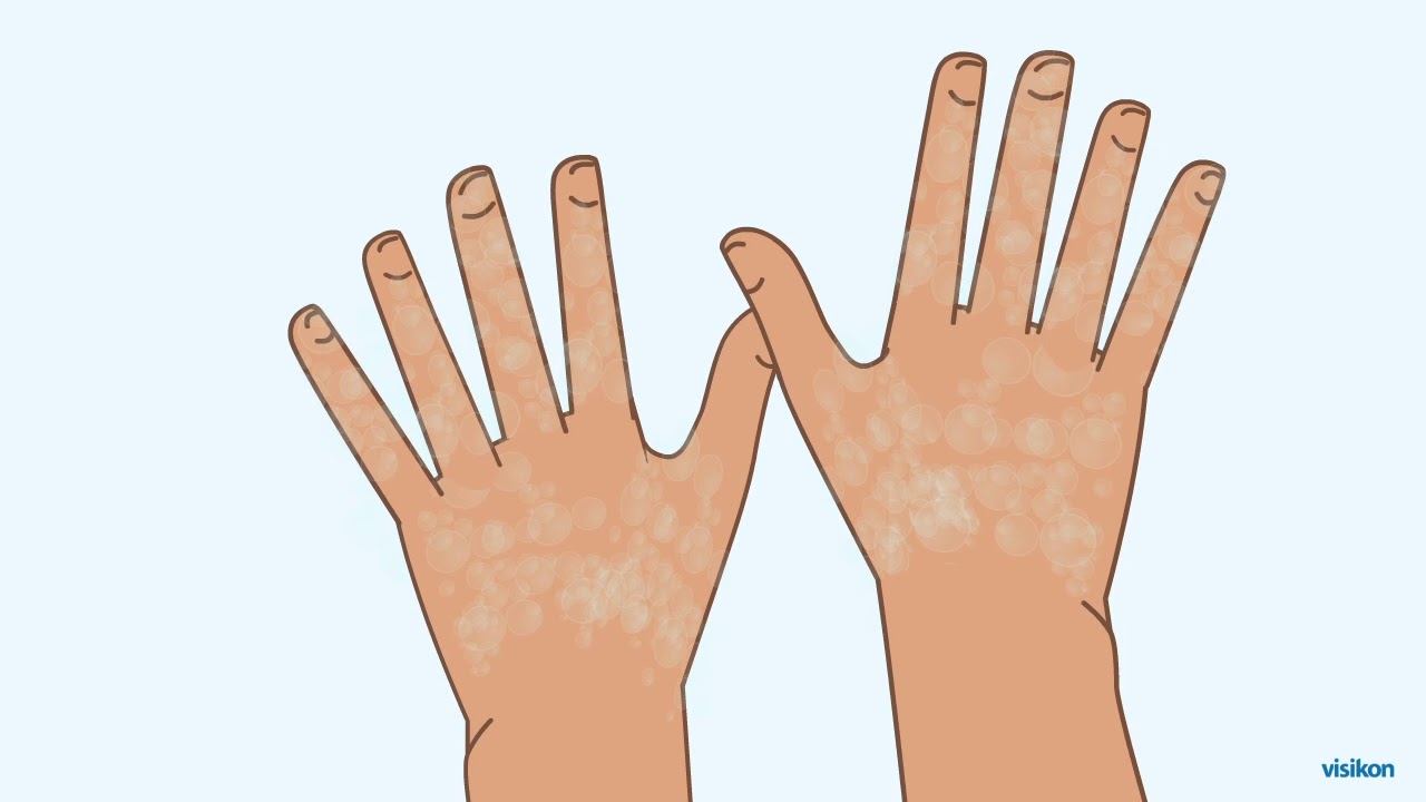 How to reduce risk of coronavirus infection (COVID-19)