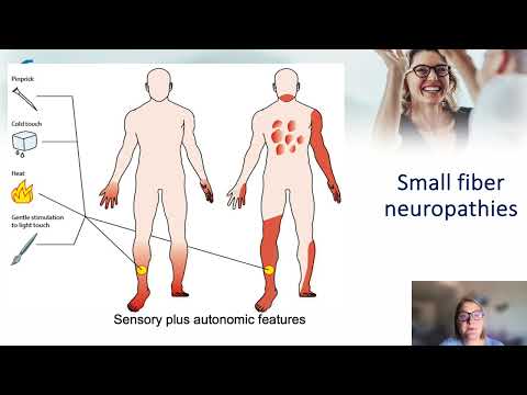 Neurological aspects in Sjögren's - Alessia Alunno ACSP2023