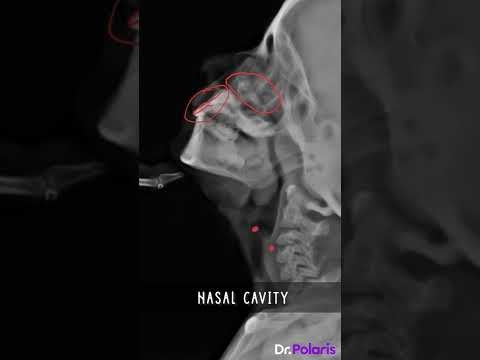 X-ray Adenoids - ENT