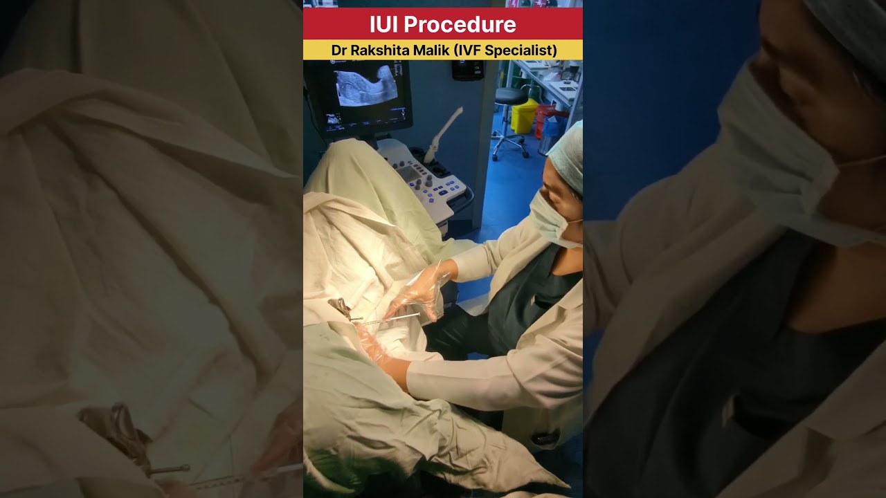 IUI Procedure ( intrauterine insemination procedure ) by Dr Rakshita Malik #ivfcenter #iuitreatment