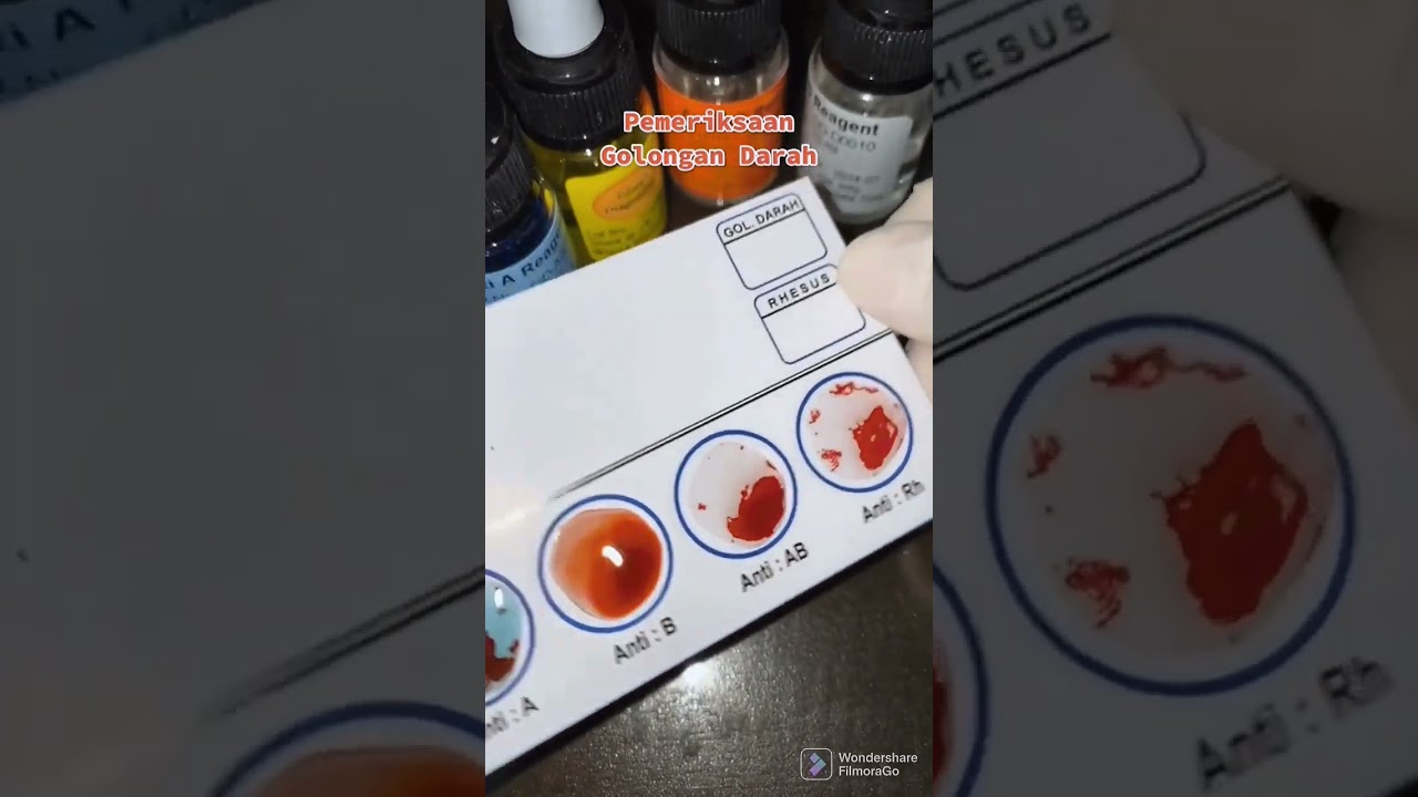 cek golongan darah.
