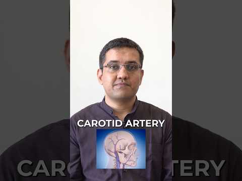 Treatment for Carotid Artery Issues 🤯