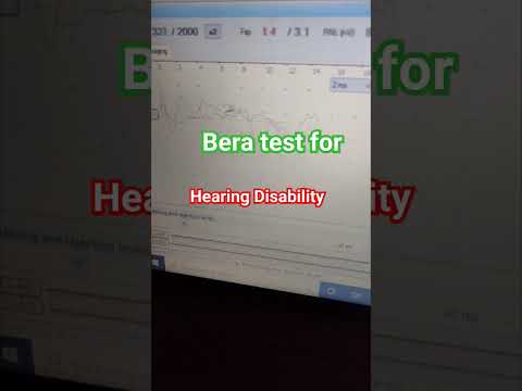 Bera test for hearing disability Percentage