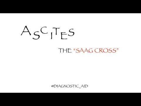 ASCITES :- "THE SAAG CROSS"