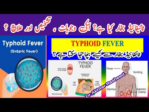 Typhoid Fever | Causes, Symptoms, Diagnosis & Treatment | Complete Guide in English