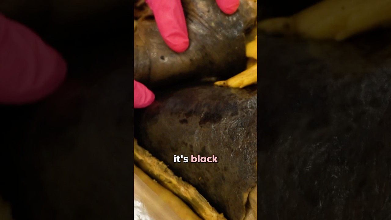 Our Most Common Request: Show Us Smokers Lungs