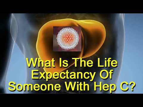 What Is The Life Expectancy Of Someone With Hep C?