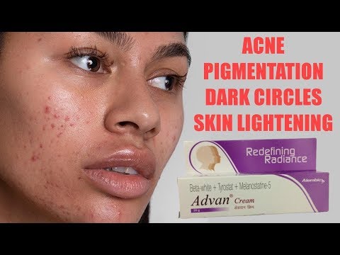 Advan Cream for Skin Lightening, Pigmentation, Dark Circles and Acne ...