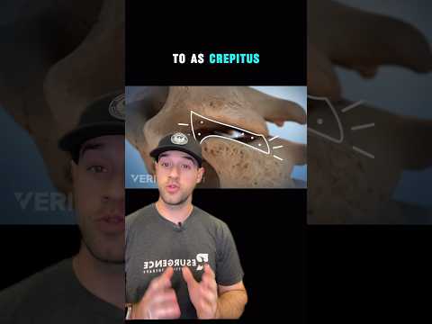 Crepitus: Do your joints have the crepitus? #stitch Credit: @StretchPadScrubs #crepitus #joints