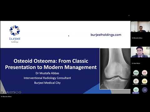 Interventional Radiology Online CME (Osteoid Osteoma From Classic Presentation to Modern Management