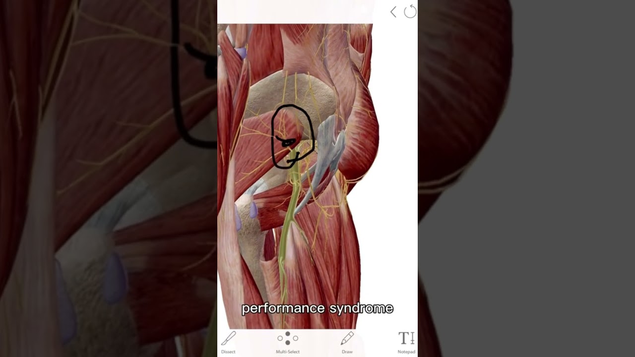 Acupuncture advantages Vs western physiotherapy