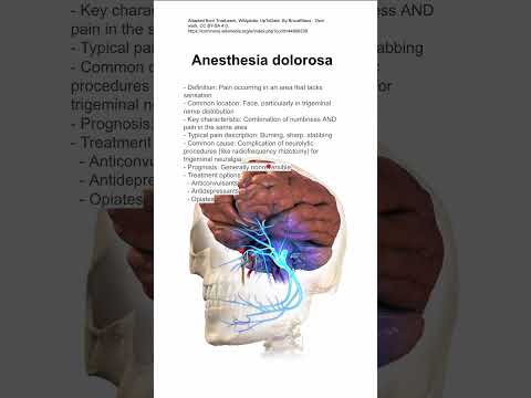 Anesthesia dolorosa