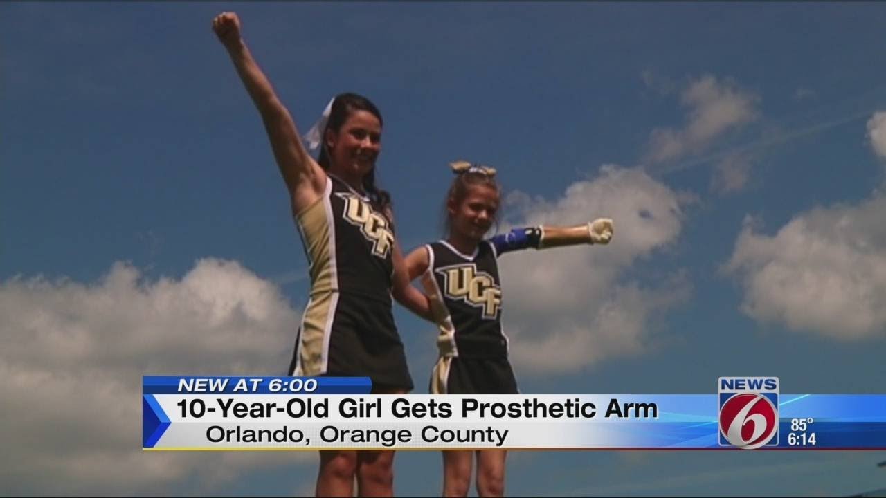 Girl gets prosthetic arm from UCF's Limitless Solutions
