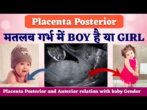 Placenta Posterior means boy or Girl | Placenta anterior means boy or Girl | Baby boy Symptoms