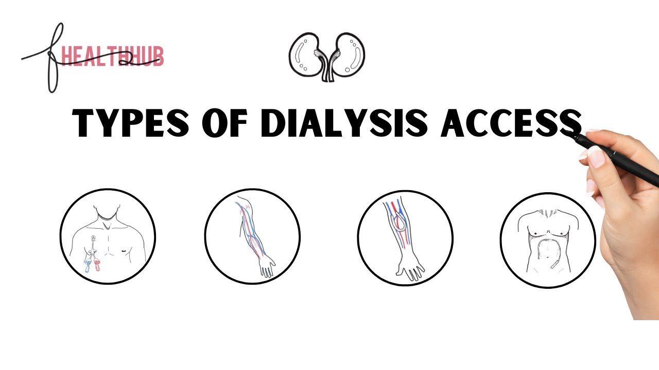 Dialysis Access Explained: Which Option is Right for You?