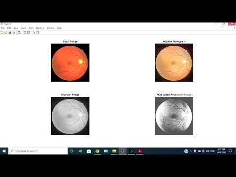 Retinal Blood Vessel Segmentation Using CNN and Image Processing
