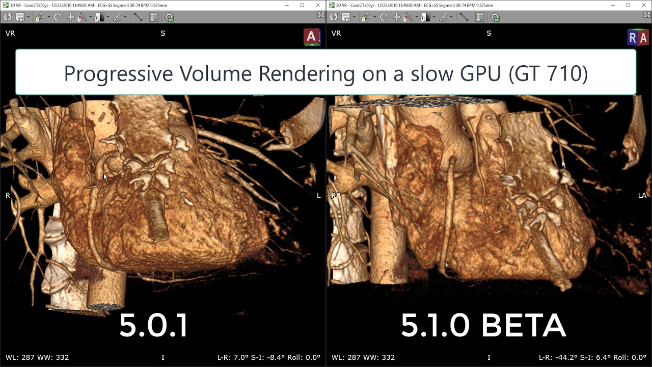 Progressive GPU accelerated Volume Rendering
