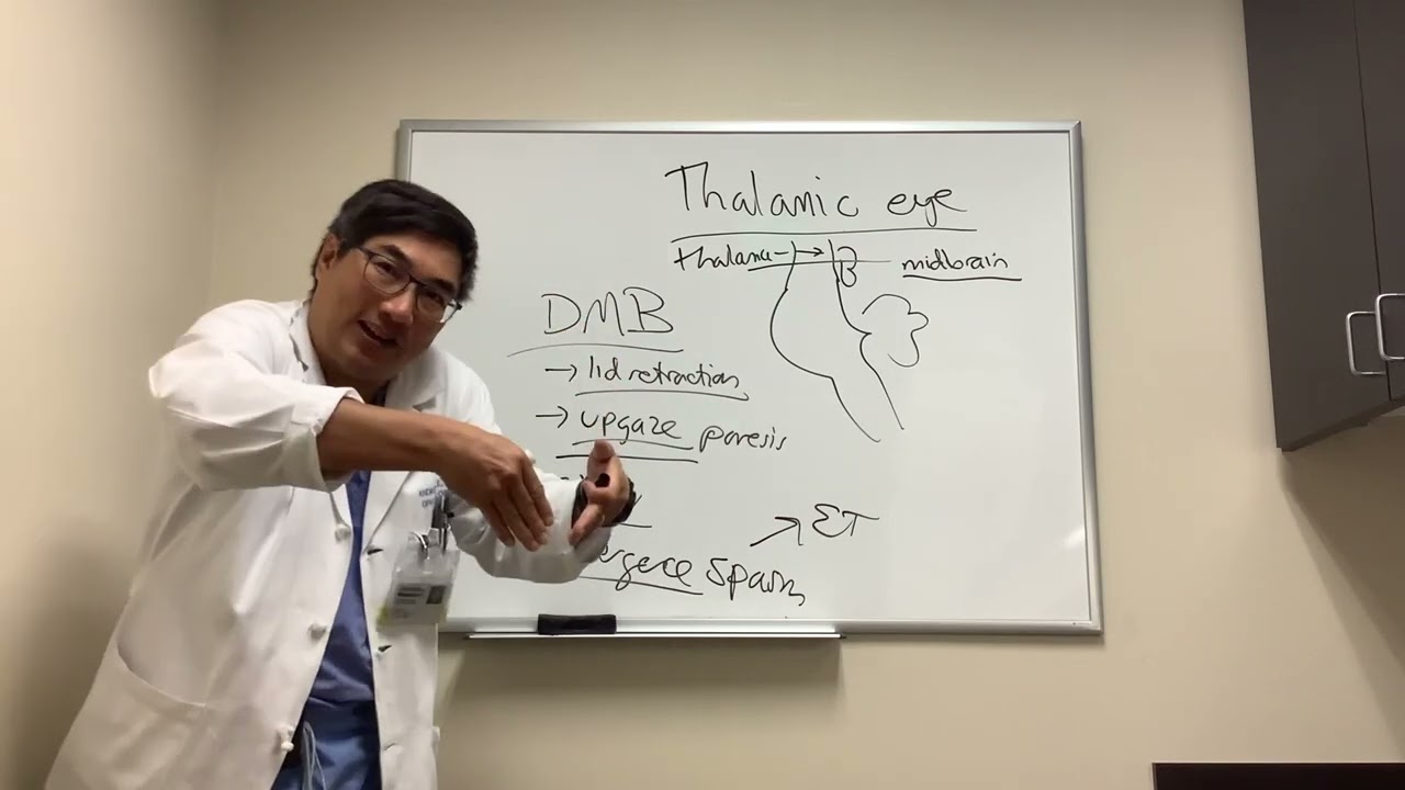 Thalamic eye signs