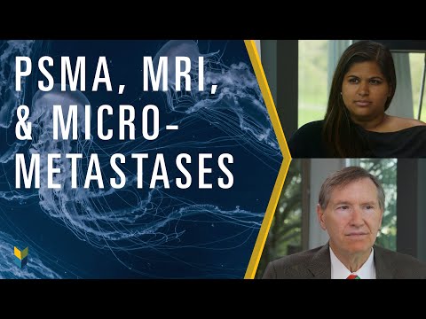 PSMA, MRI, & Micro-Metastases | Answering YouTube Comments #22 | Mark Scholz, MD