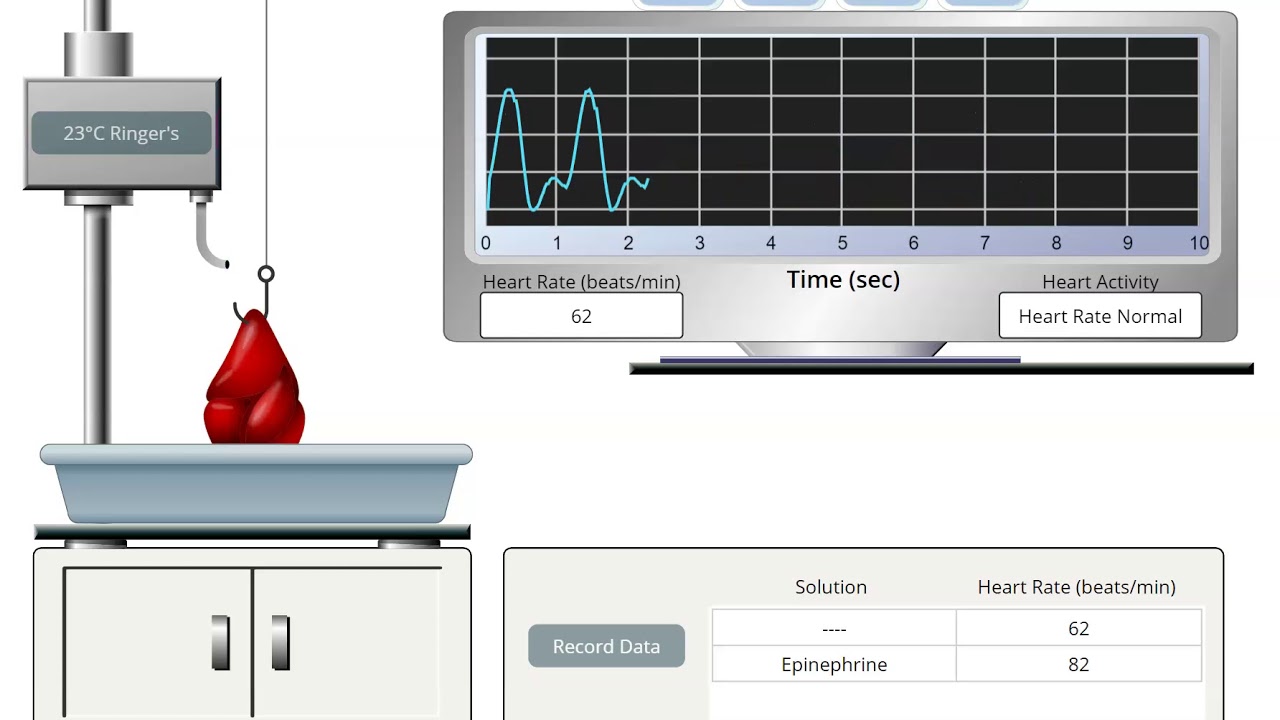 PhysioEx10 Exercise 6, activity 4